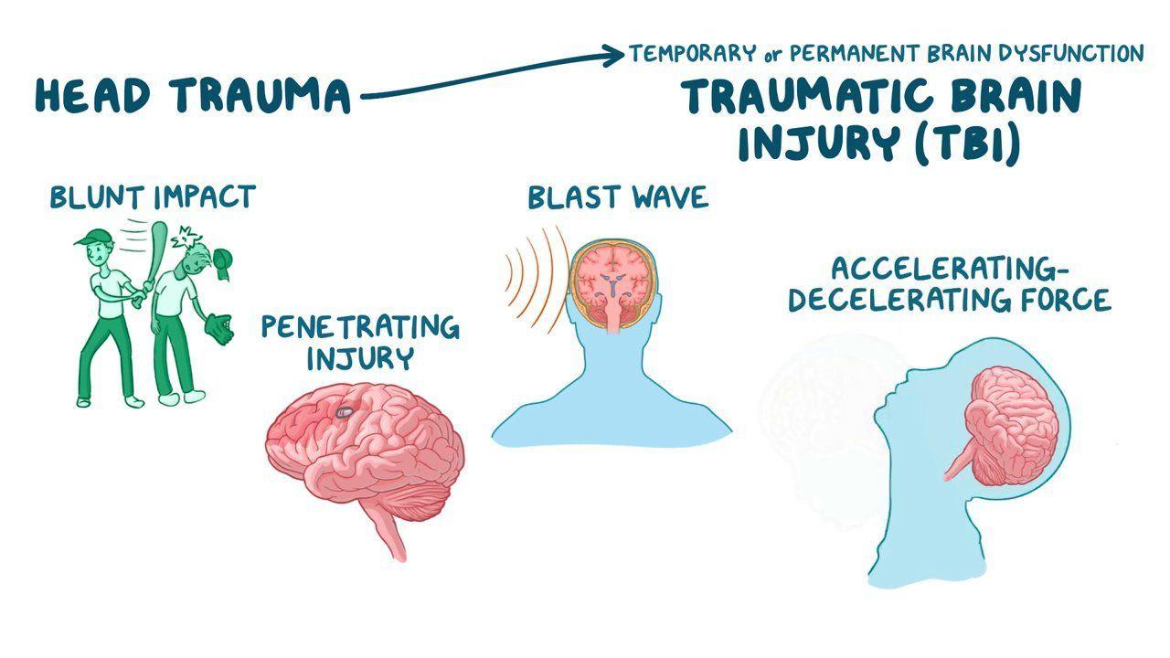 Traumatic Brain Injury Clinical Video Causes Meaning Osmosis Traumatic Brain Injury Clinical Video Causes Meaning Osmosis