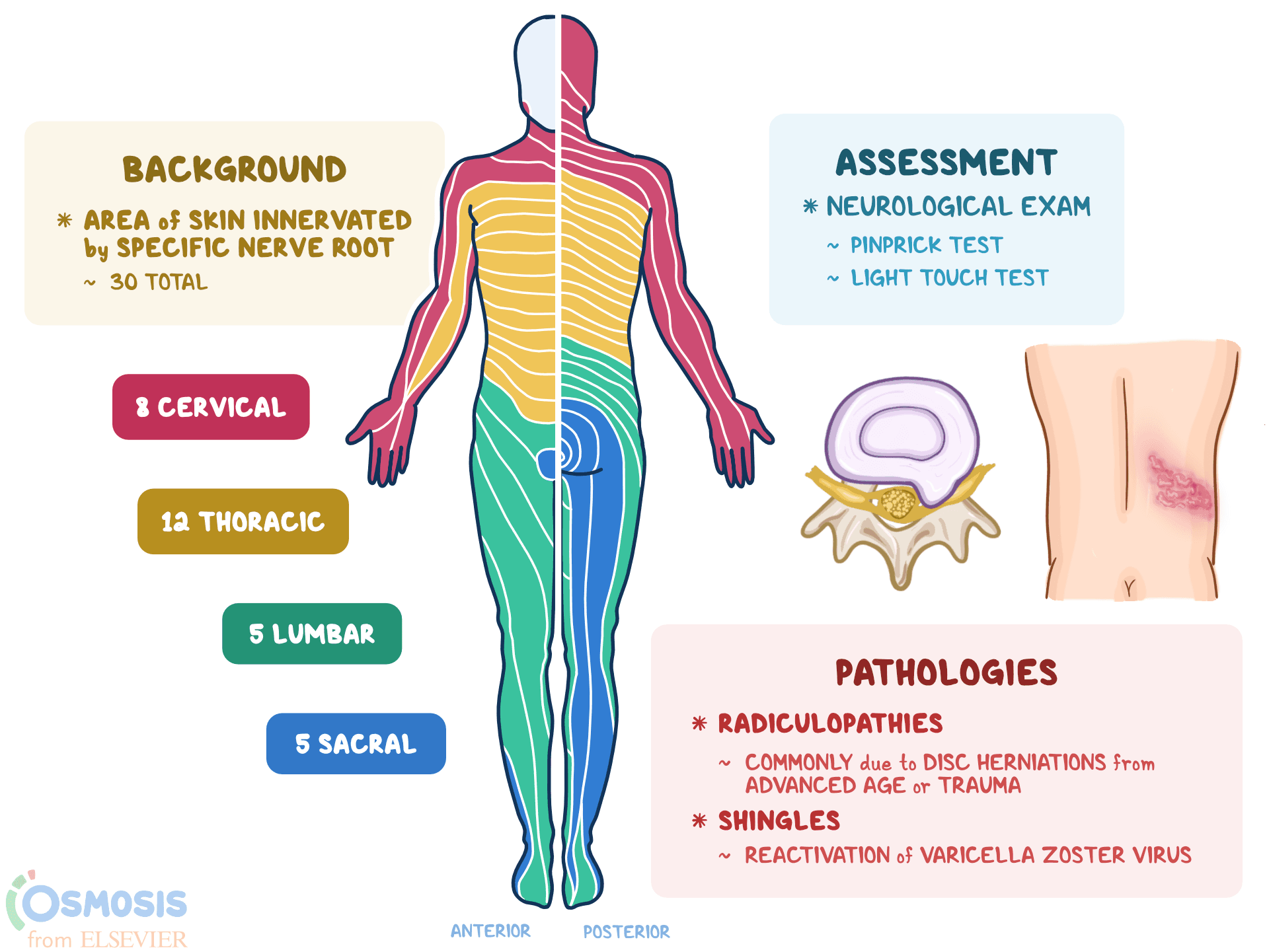 Dermatomes What Are They Related Diseases And More Osmosis Dermatomes What Are They Related Diseases And More Osmosis
