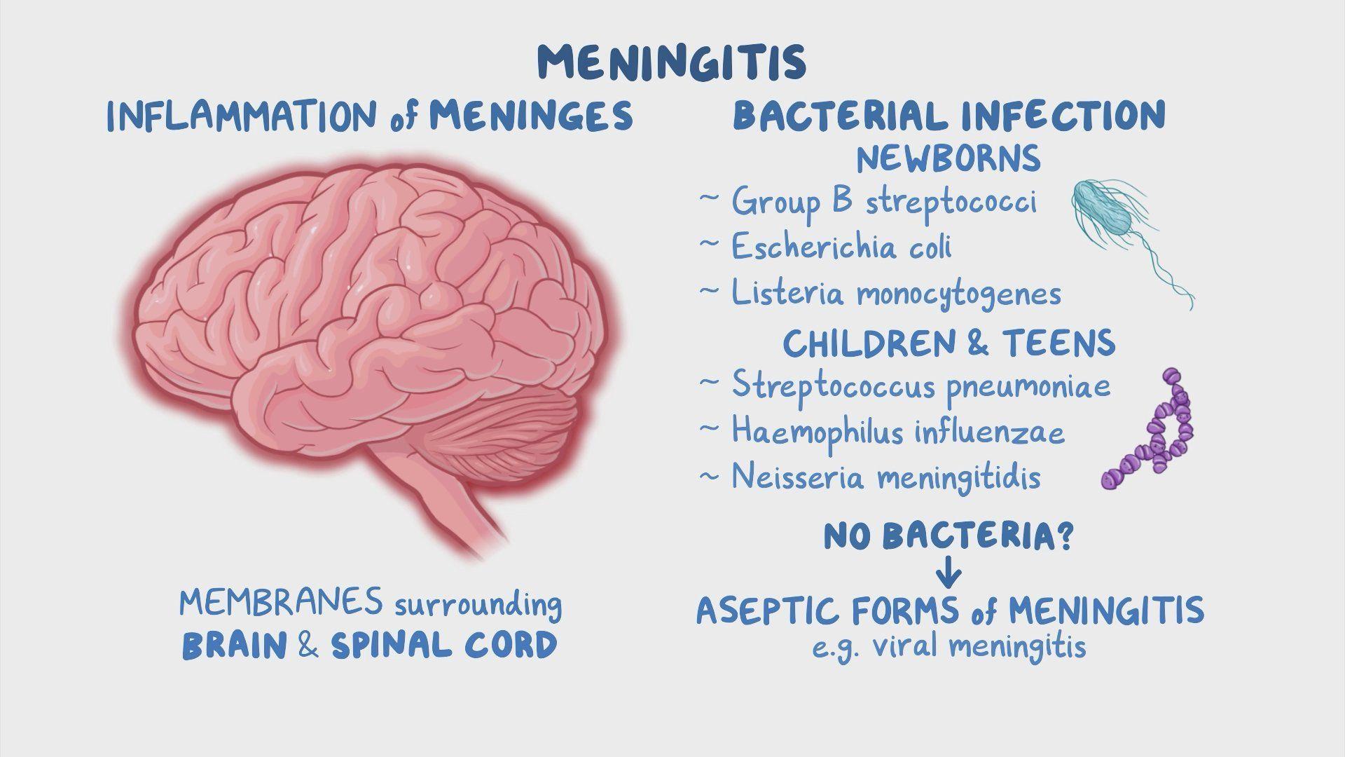 Meningitis pediatrics Video Meaning Osmosis Meningitis pediatrics Video Meaning Osmosis