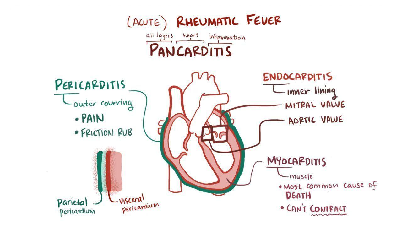 Cardiopat a Reum tica V deo Anatom a Definici n Osmosis Cardiopat a Reum tica V deo Anatom a Definici n Osmosis