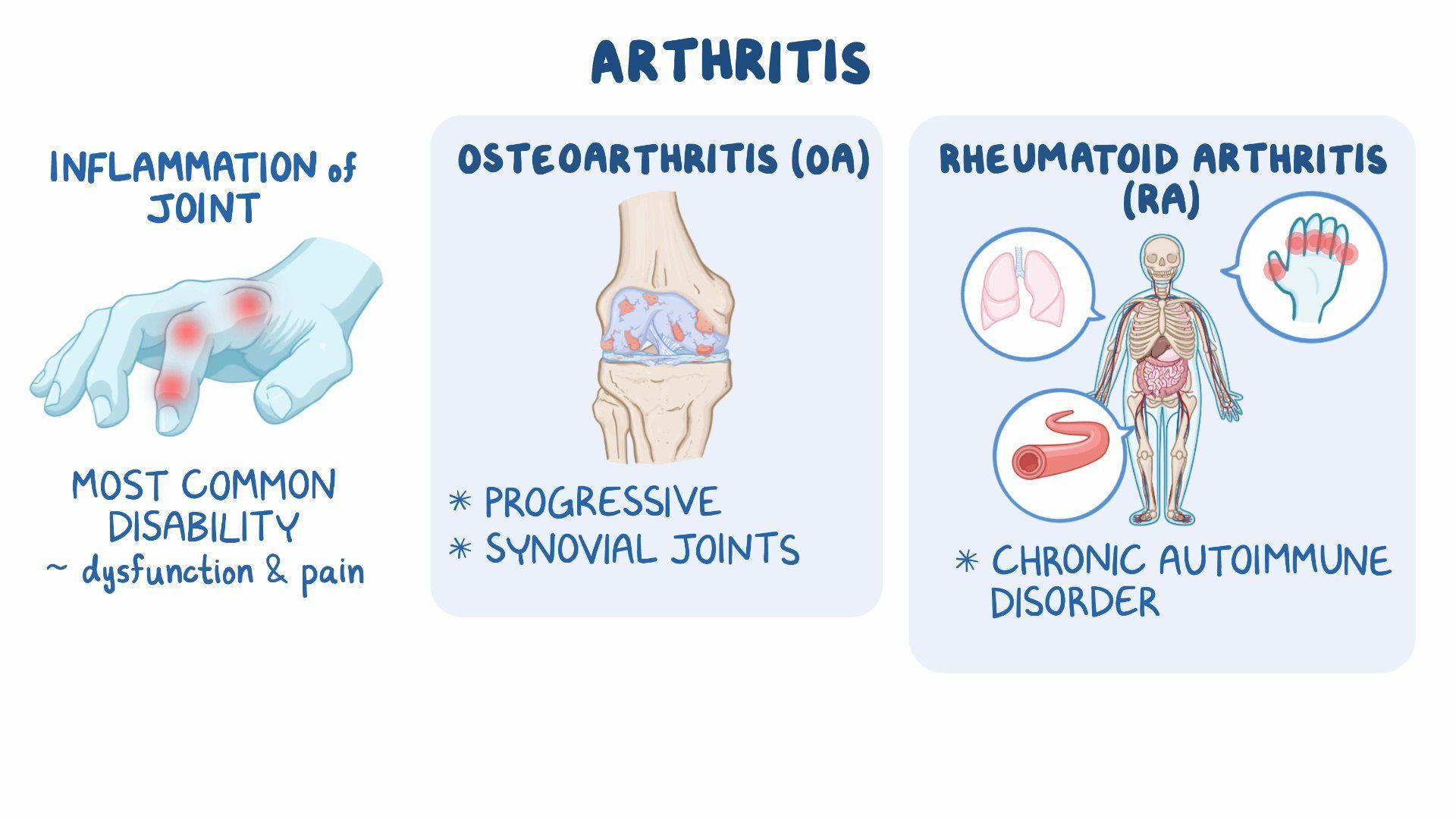 Osteoarthritis And Rheumatoid Arthritis Osmosis Video Library Osteoarthritis And Rheumatoid Arthritis Osmosis Video Library