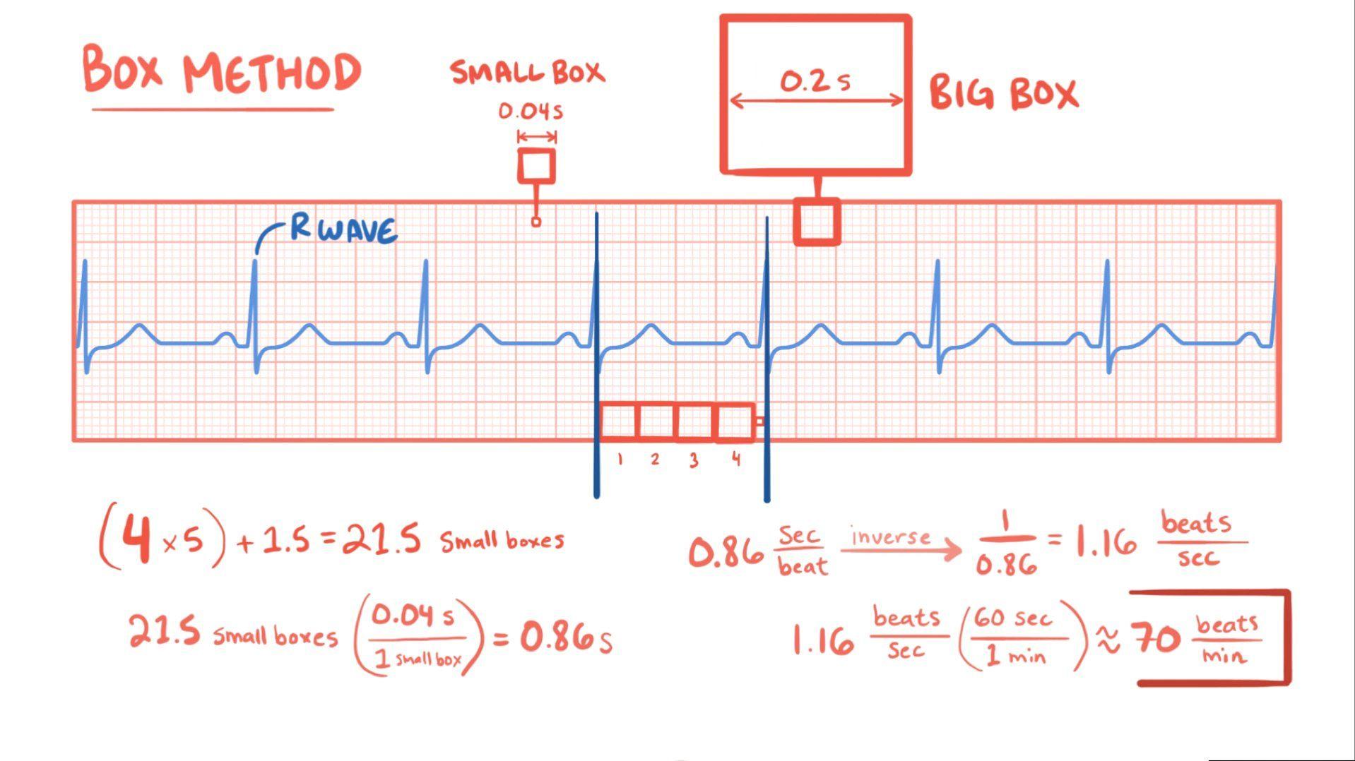 ECG Rate And Rhythm Video Anatomy Definition Osmosis ECG Rate And Rhythm Video Anatomy Definition Osmosis