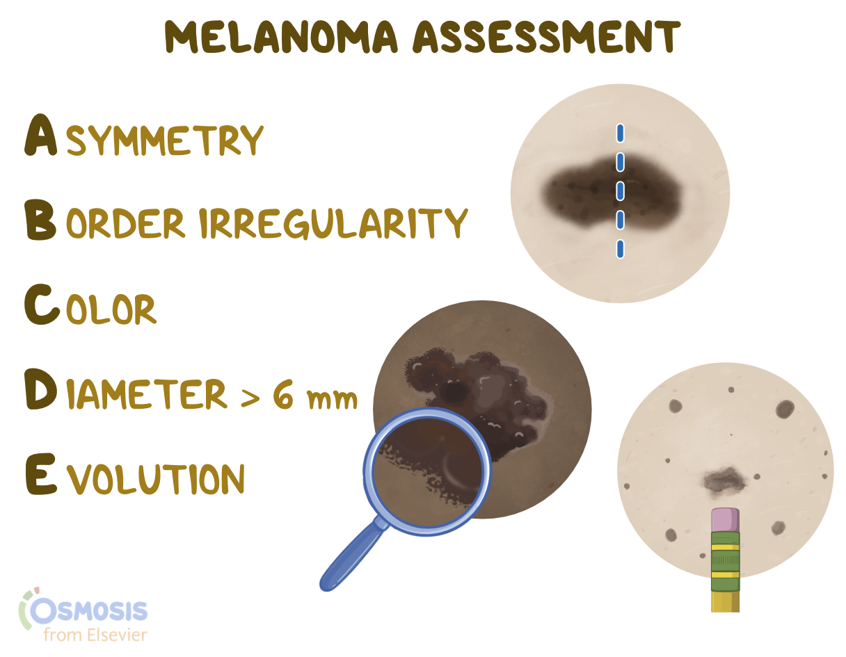 The Top 10 Helpful Medical Mnemonics from Osmosis - Osmosis Blog