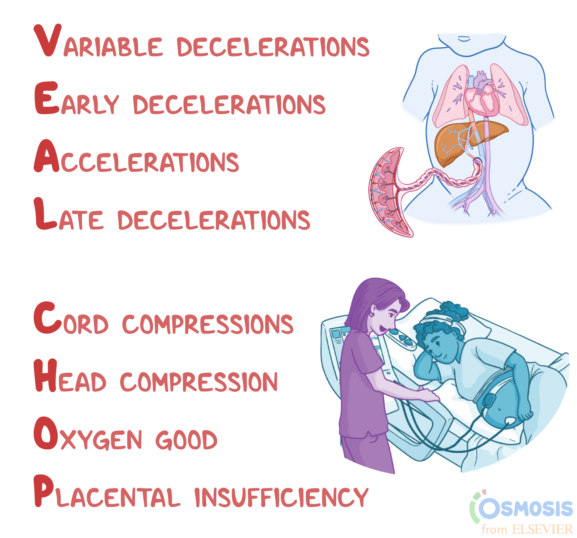 The Top 10 Helpful Medical Mnemonics from Osmosis - Osmosis Blog