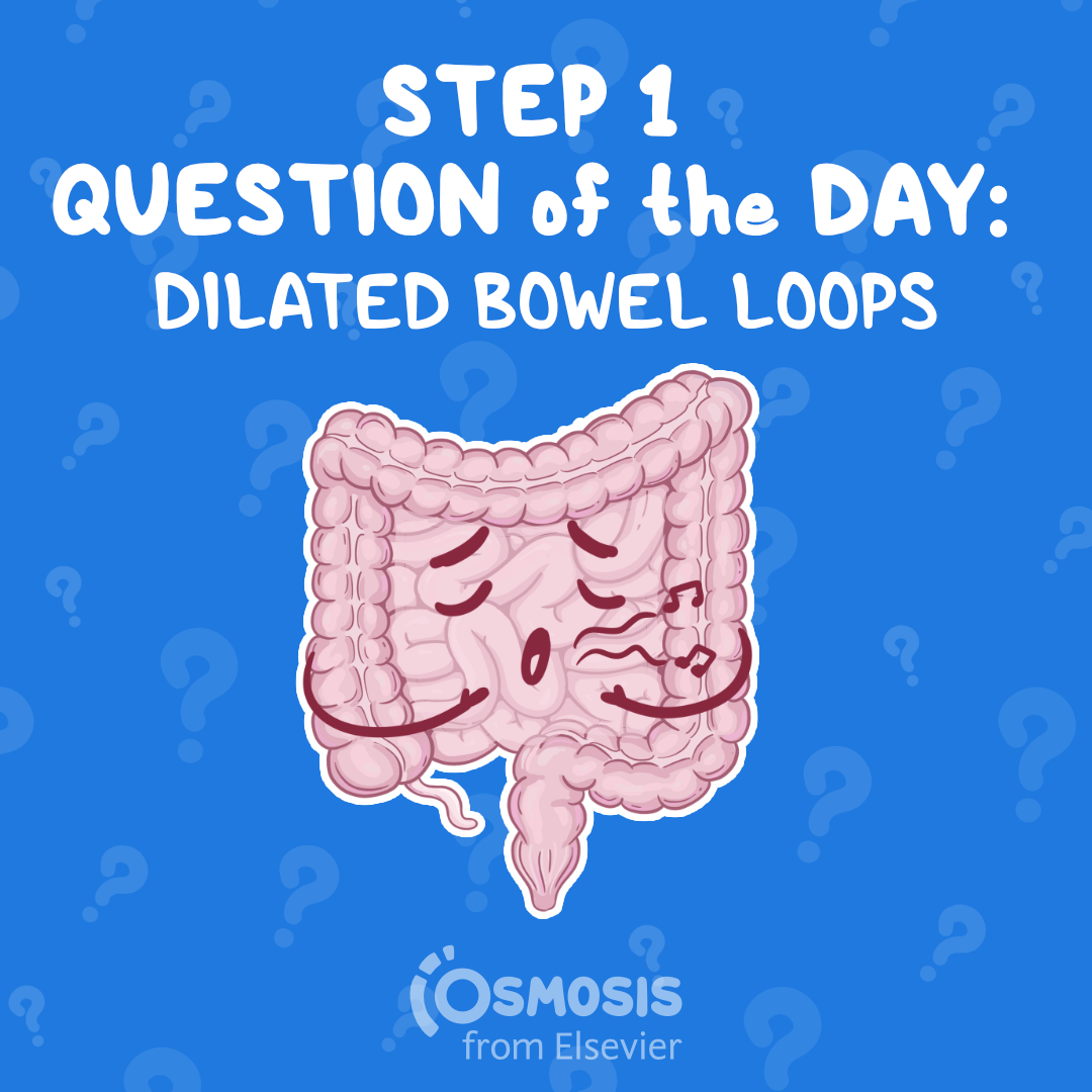 USMLE® Step 1 Question of the Day: Dilated bowel loops - Osmosis Blog